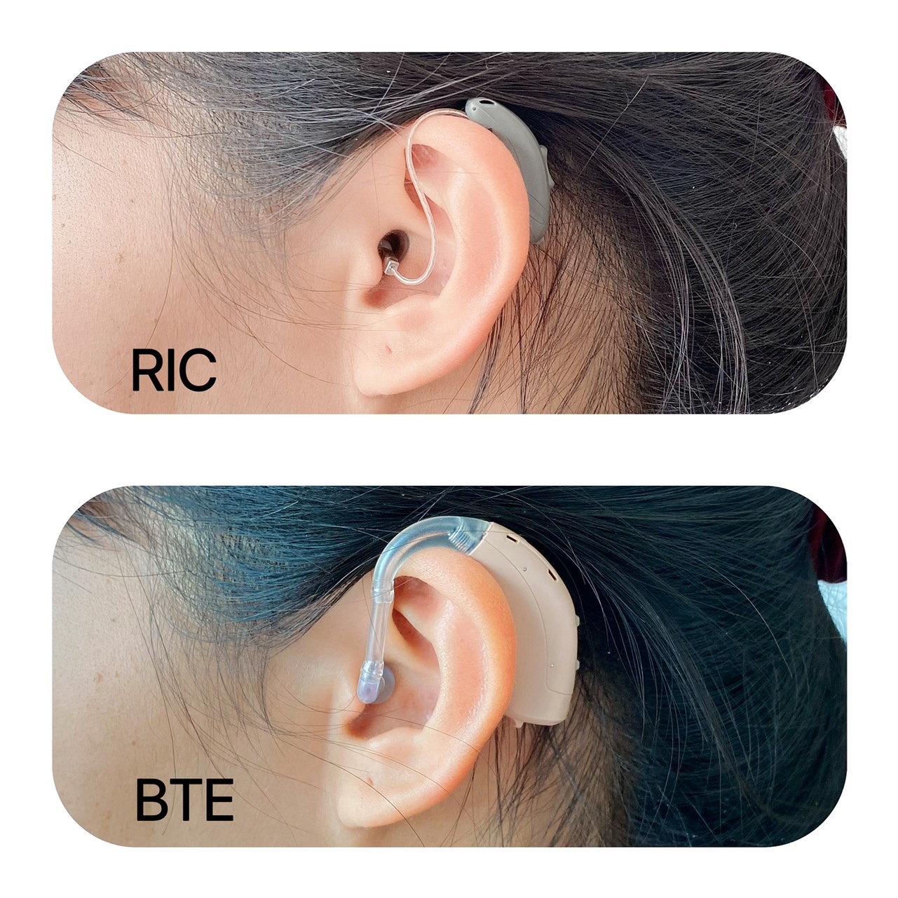 เครื่องช่วยฟัง RIC และ BTE แตกต่างกันอย่างไร? - ศูนย์บริการพิเศษเครื่อง ...